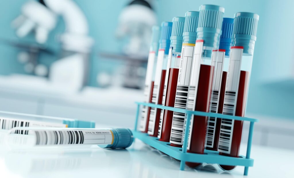 Complete Blood Count Fairfax - Full Blood Count South Riding